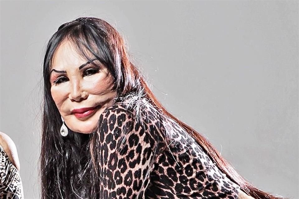 FOTOS: Así se ve el nuevo rostro de Lyn May que causa furor en las redes